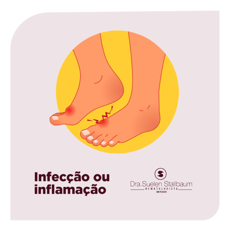 Infecção ou inflamação? Como saber qual o correto? - Dra. Suellen Stallbaum