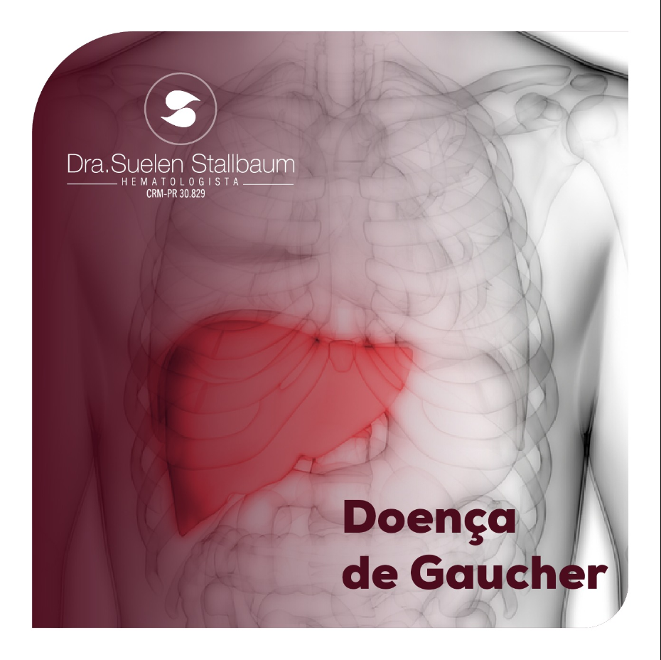 Doença De Gaucher Expectativa De Vida - RETOEDU